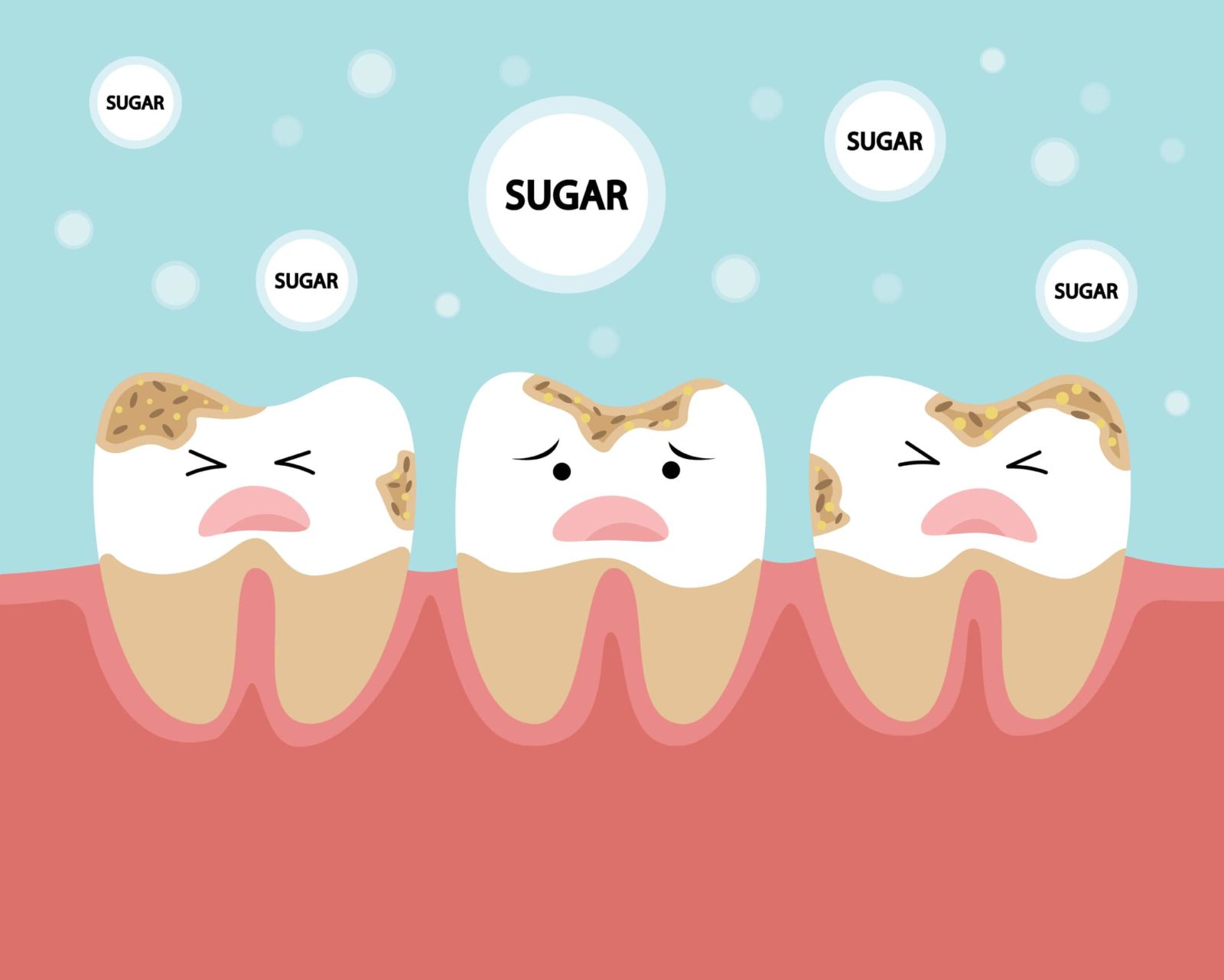 How Long Does It Take For Cavities To Form Dentist In Marysville